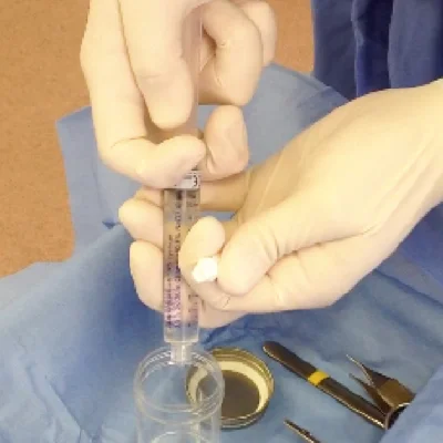 Harvest and Injection — Cell Therapy Sciences