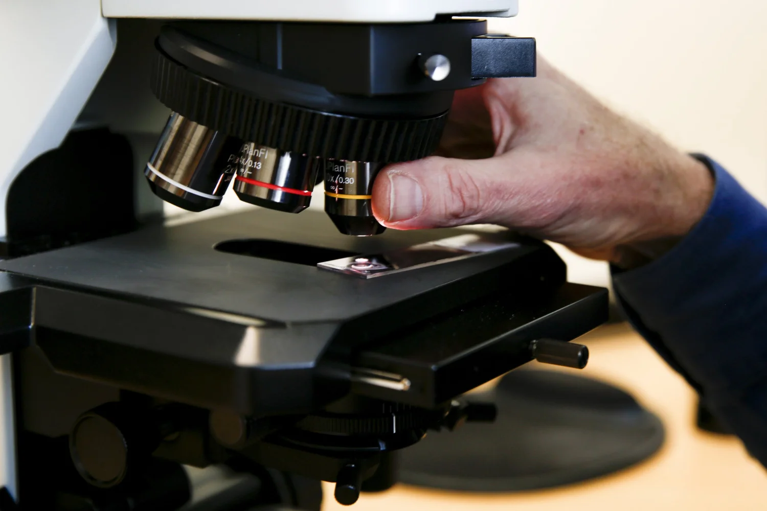 UCSF Dermatopathology & Oral Pathology Service — UCSF Dermatopathology ...