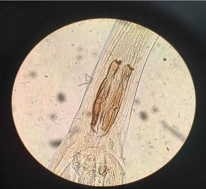 Parasites of Interest — Invetus