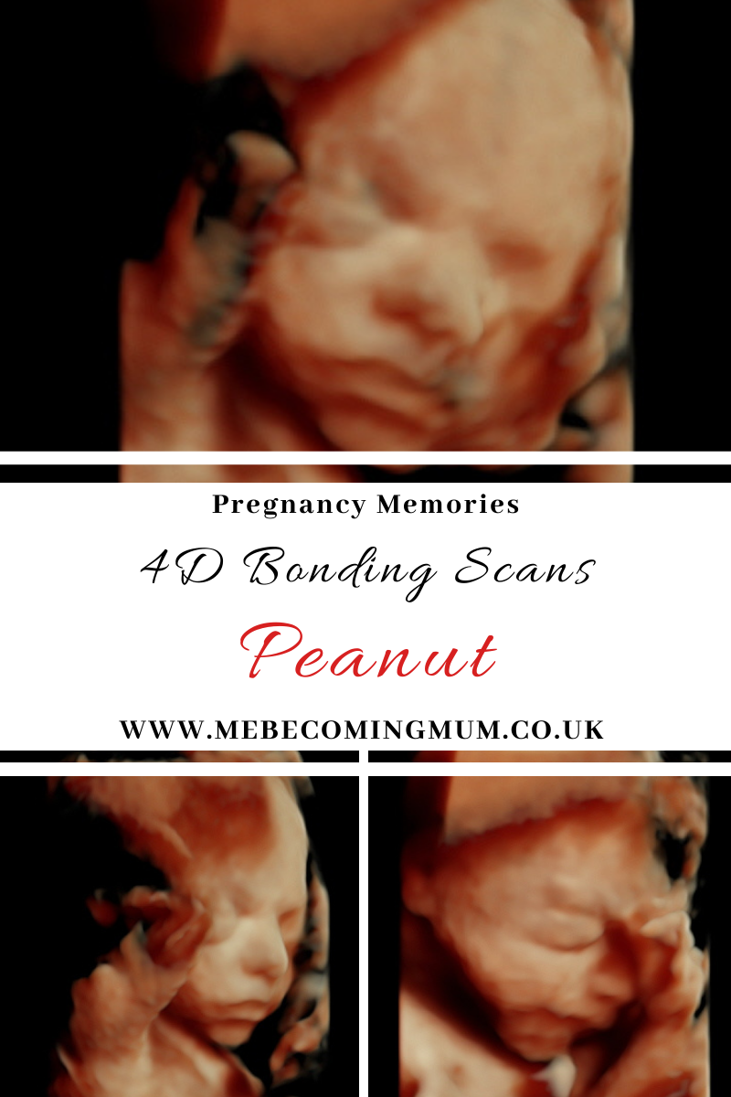 Peanut's 4D Bonding Scan | Baby I Love You, Carlisle | Me Becoming Mum