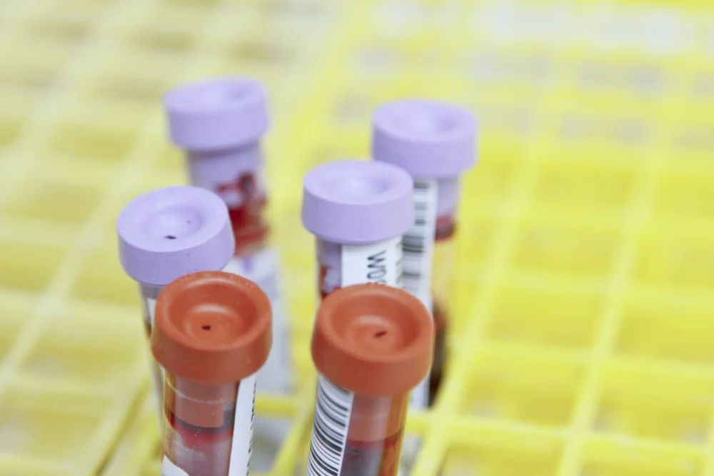 WHY ALL ENDURANCE ATHLETES SHOULD HAVE A PERFORMANCE BLOOD TEST ...