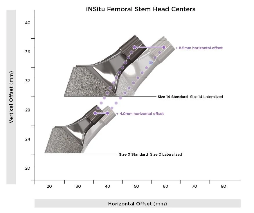 iNSitu Quad-Taper Hip System — NextStep