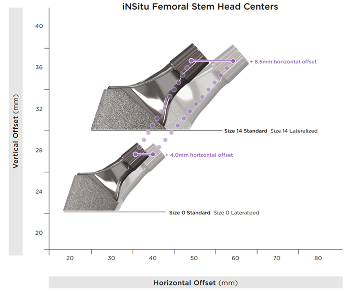 iNSitu Quad-Taper Cemented Hip System — NextStep
