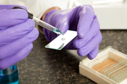 Why Human Tissue Samples are The Key to Progress in Cancer Research