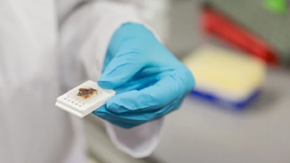 The Pros and Cons of FFPE vs Frozen Tissue Samples