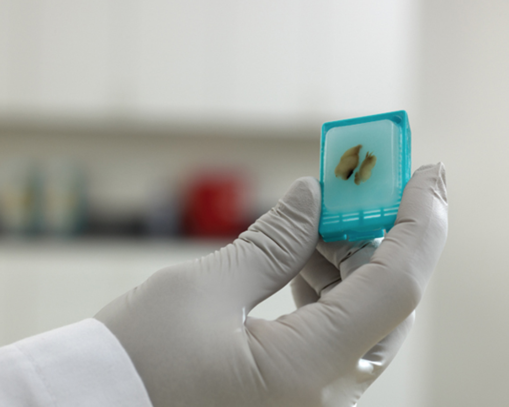 FFPE Tissue and it's Use in Biobanks