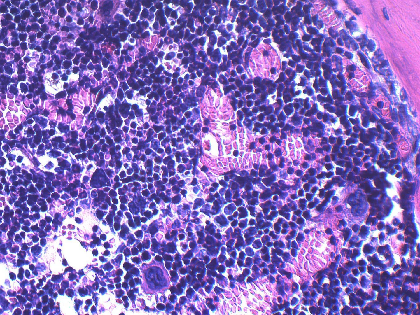 The Two Types Of Bone Marrow The Two Types Of Bone Marrow