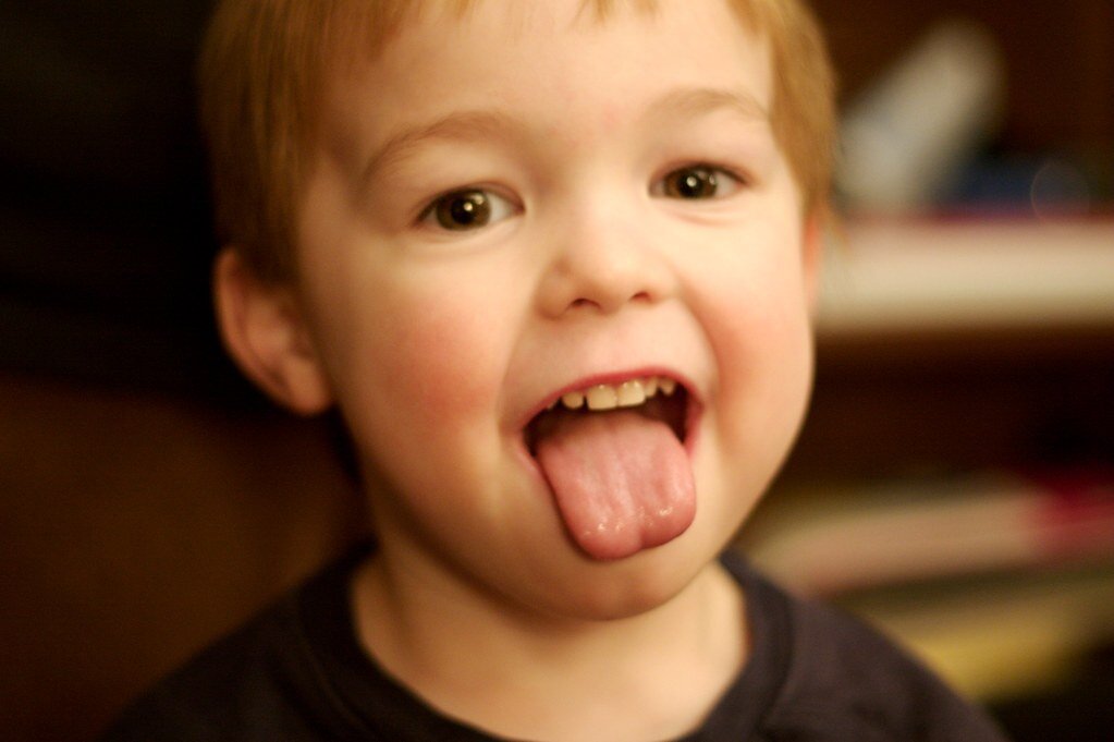 Tongue Ties — Cft The Gillespie Approach
