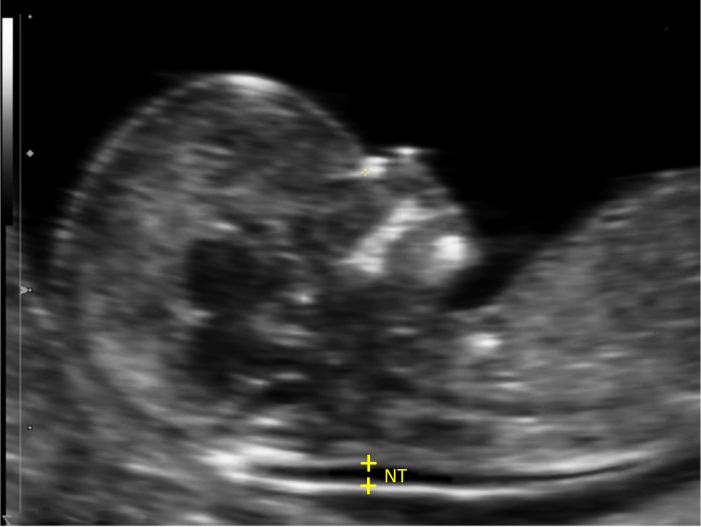 Obstetric — Nufw