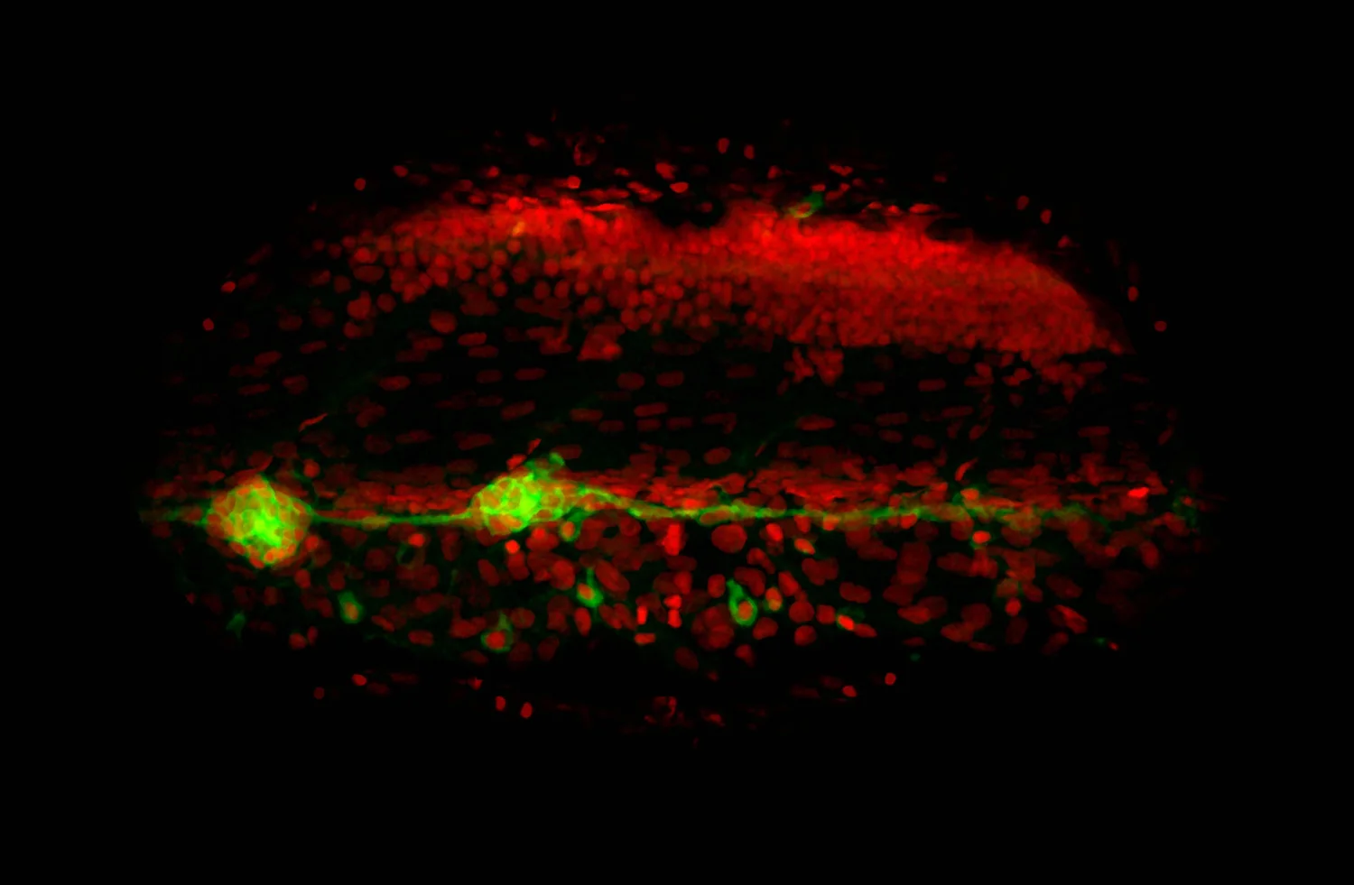 Posterior Lateral Line Nerve — Zebrafish UCL