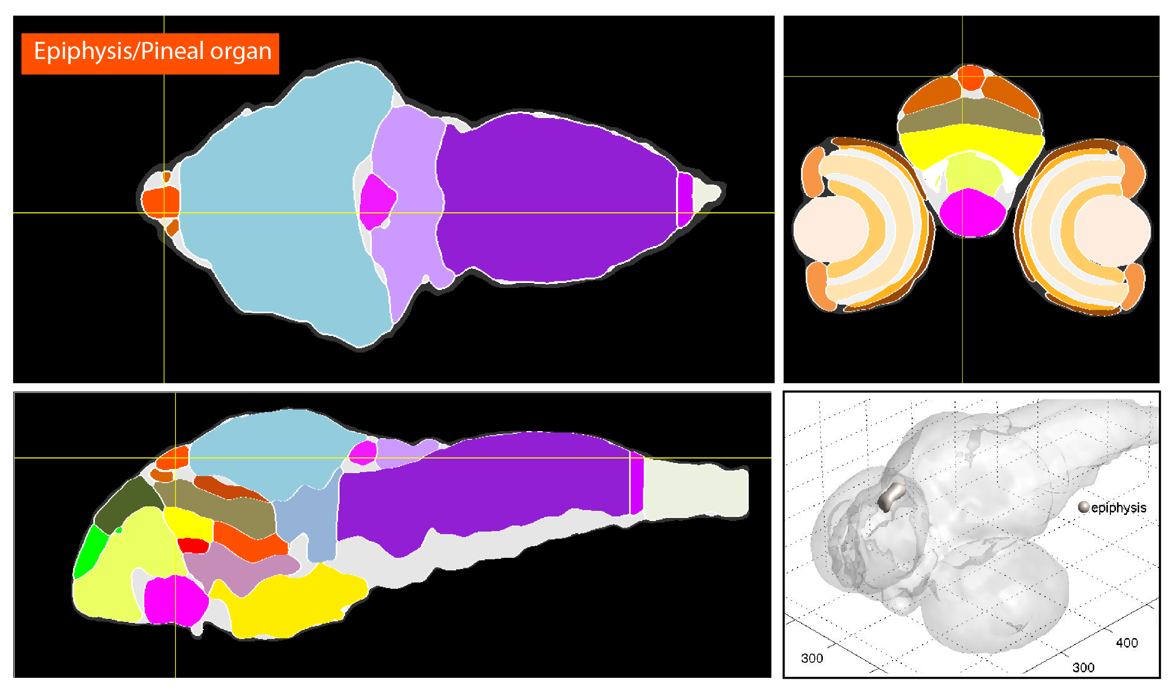pineal complex/epiphysis — Zebrafish UCL