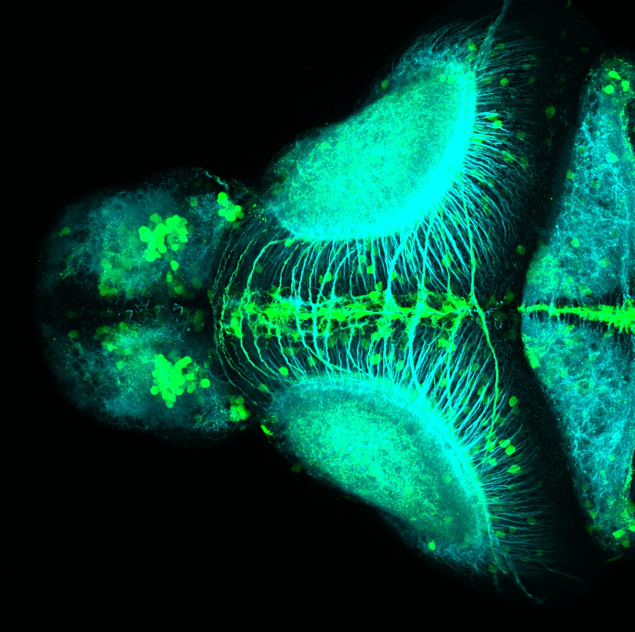 subpallium/ ventral telencephalon — Zebrafish UCL