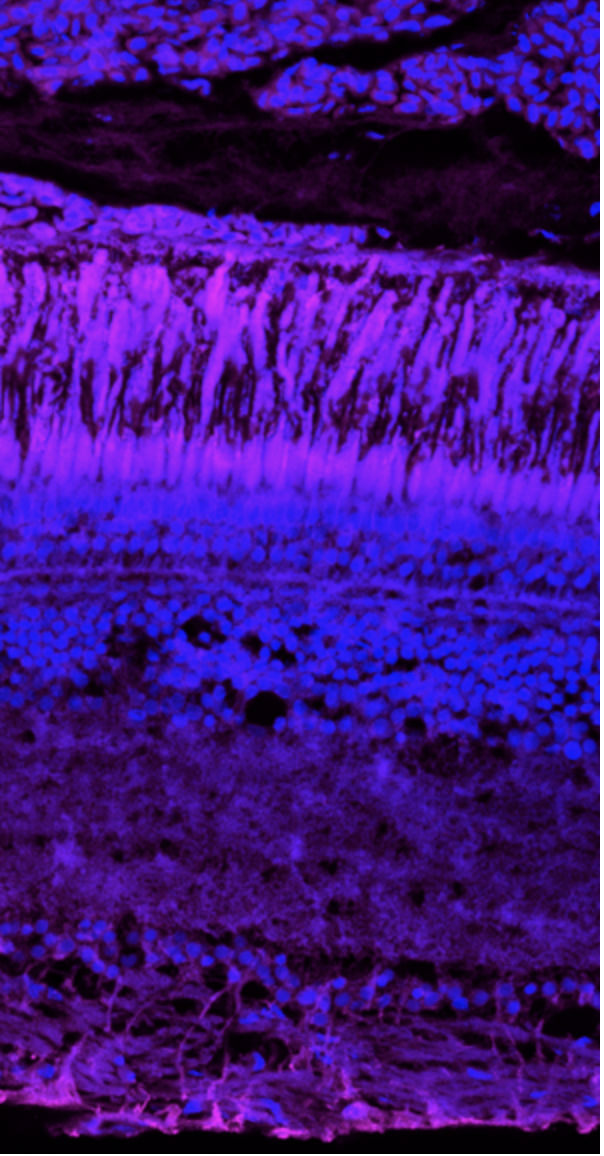 Killifish — Zebrafish UCL