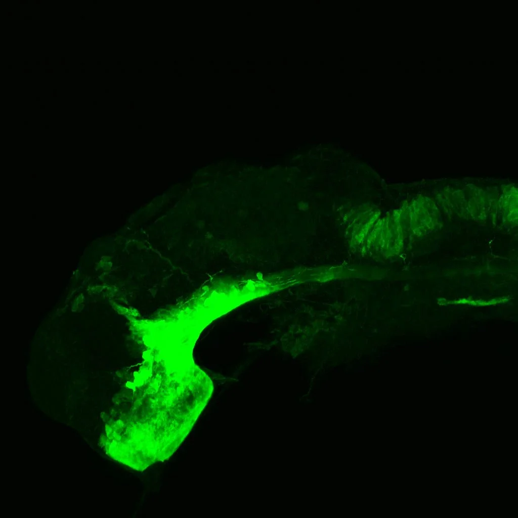 Eye Gene Screen Phenotypes — Zebrafish UCL