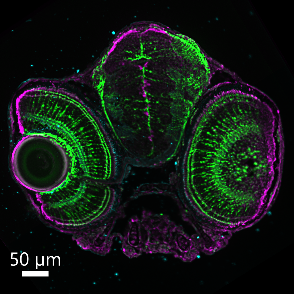 Ibex — Zebrafish UCL