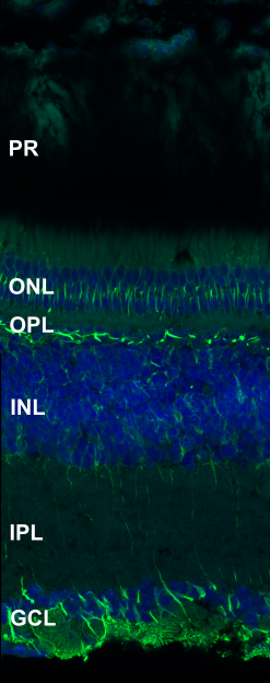 Glial fibrillary acidic protein (Gfap) — Zebrafish UCL