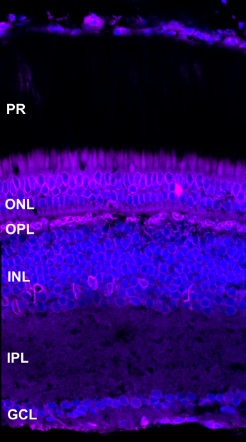 Proliferating cell nuclear antigen (PCNA) — Zebrafish UCL