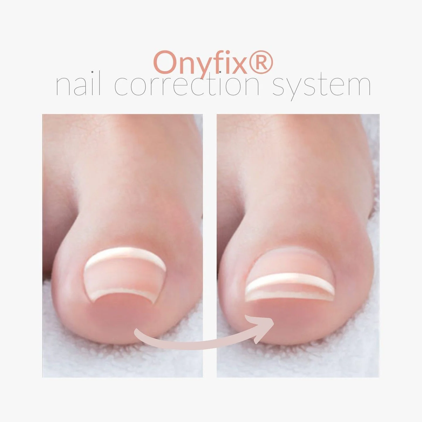 Blackwood Podiatry | Your local podiatrist in Blackwood