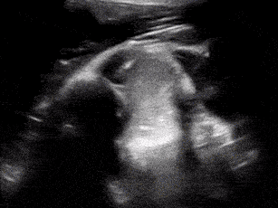Image Atlas Home — TPA