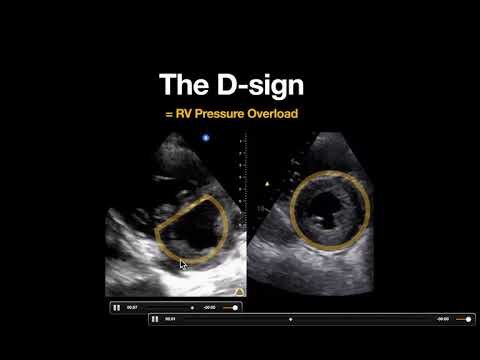 One Minute Image Review- Echo — TPA