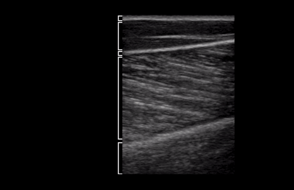 Soft Tissue Image Gallery — TPA