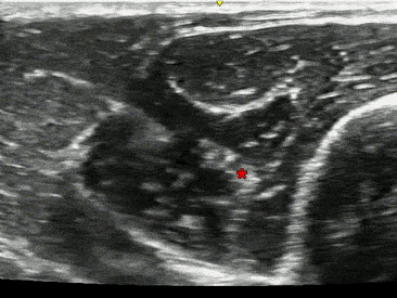 Nerve Block Atlas Home — TPA