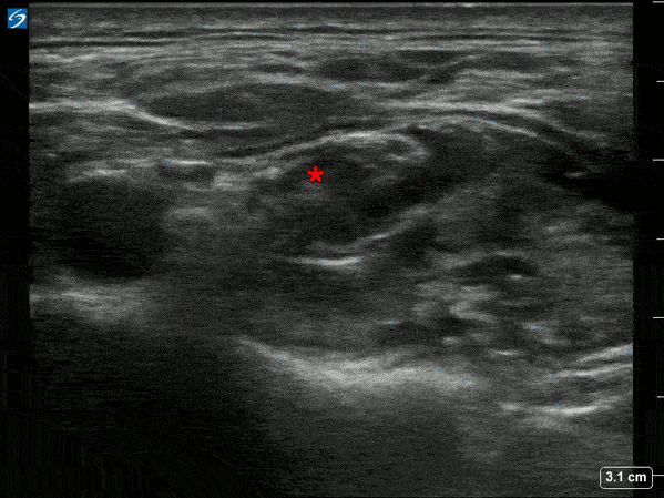 Nerve Block Atlas Home — TPA