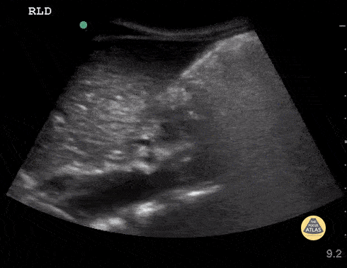 Peds-Gastrointestinal — TPA