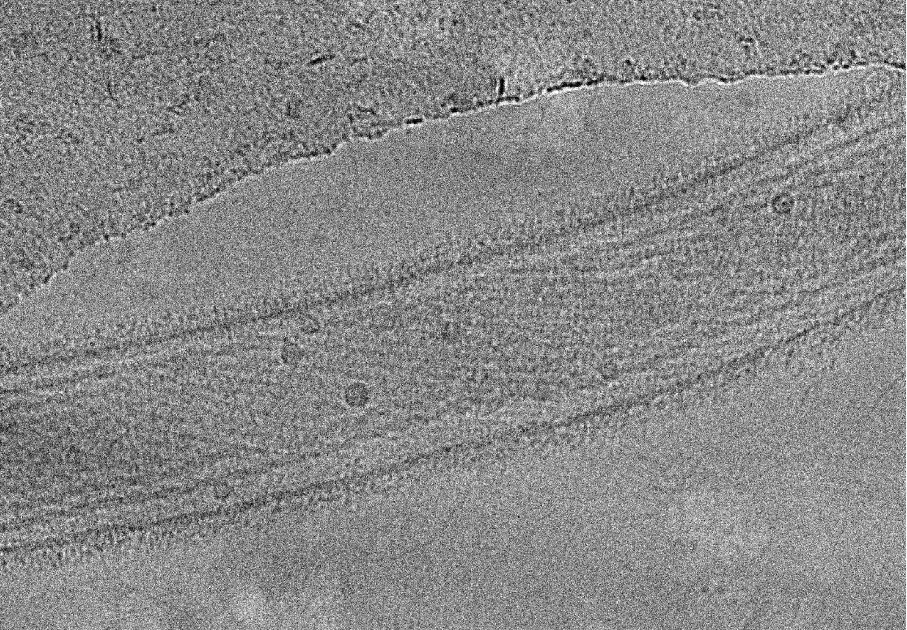 Microsporidia — Bhabha + Ekiert Labs