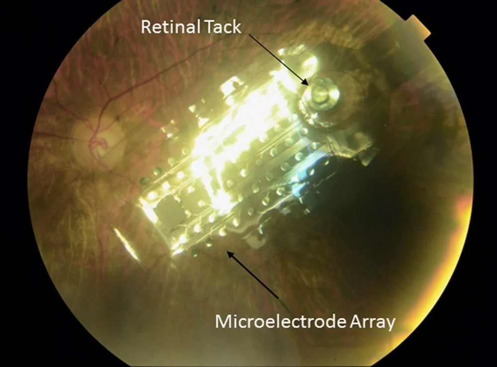 Equal, Round, and Reactive: Lessons from our Pupils. — Straight from ...