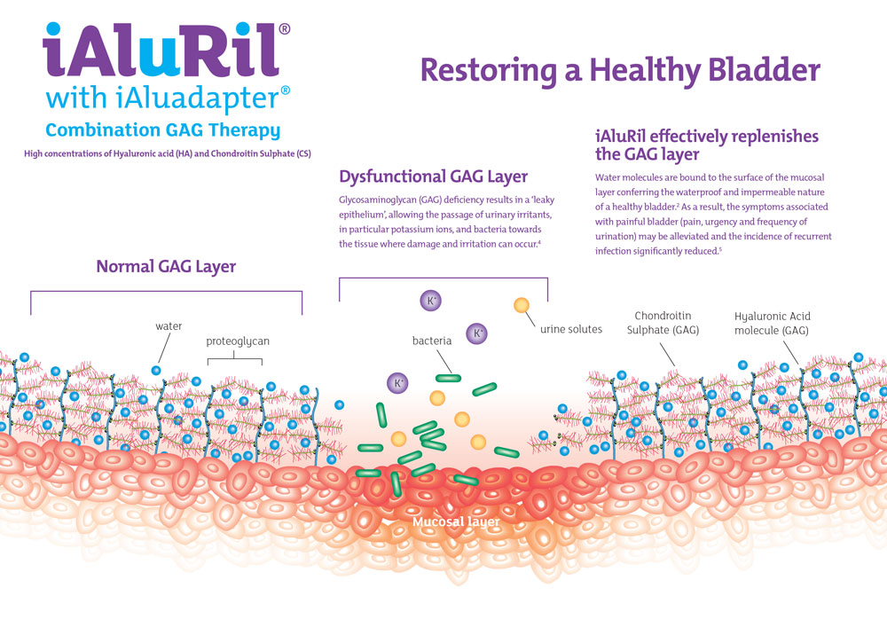 iAluRil® - Aspire Pharma - Distributed by Caragen in UK and Ireland ...