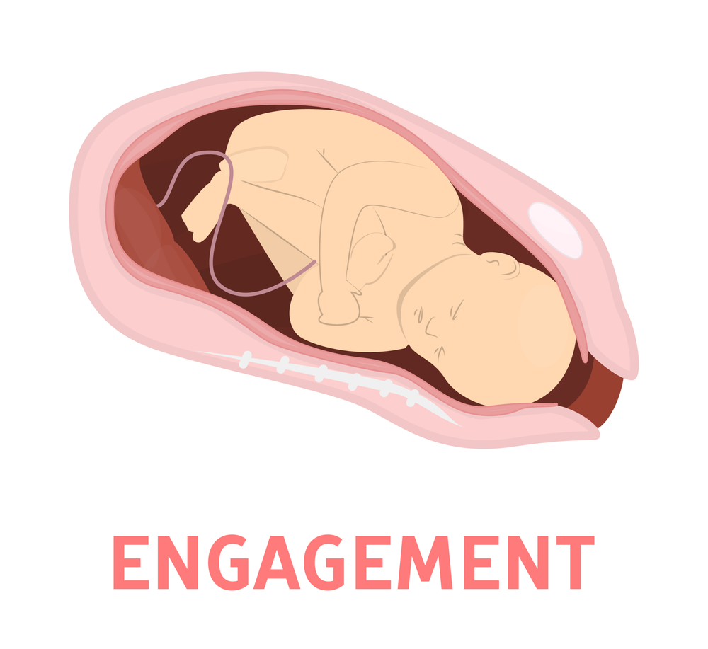 Anatomy Bony Pelvis In Labor
