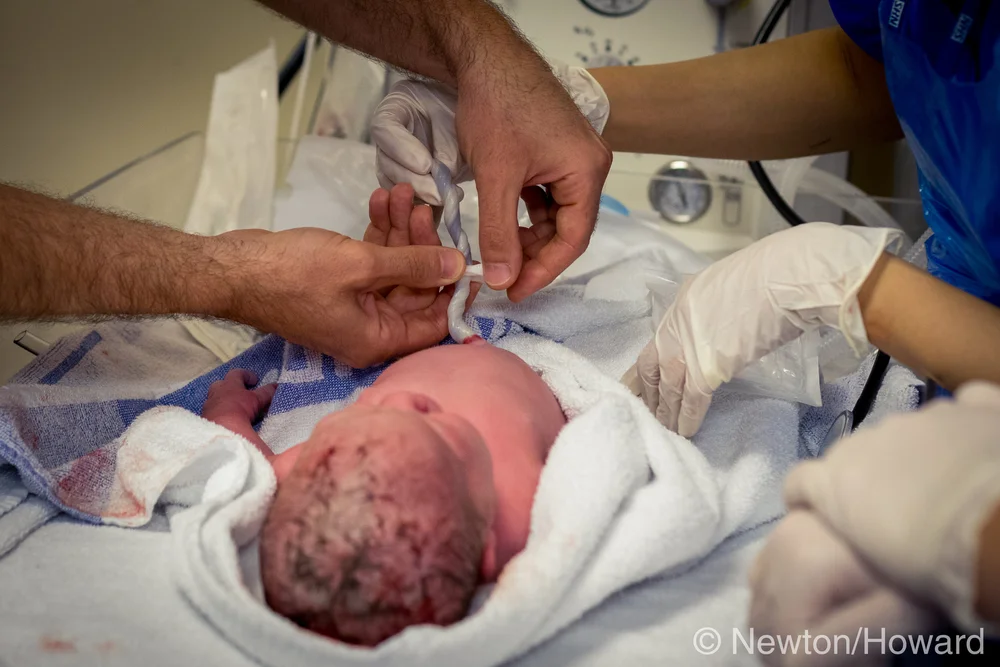 The story of these powerful photos of a C section and the birth of my ...