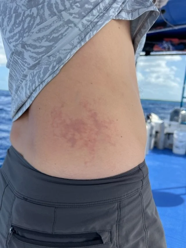 Decompression (DECO) vs Decompression Sickness (DCS) Part 2: DCS for Me ...