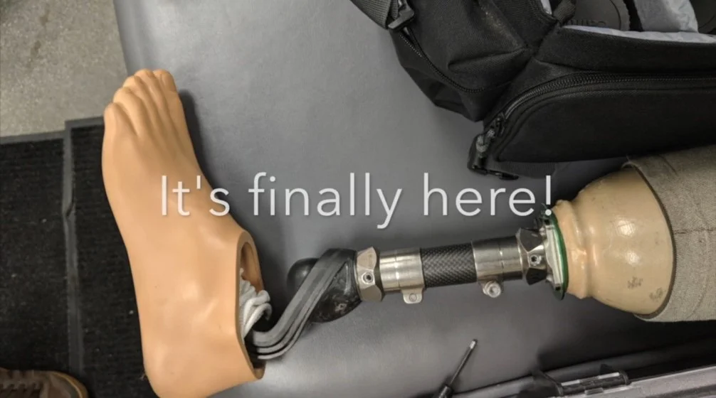 Gait App Update: Prosthetic Gait Deviations is now available ...