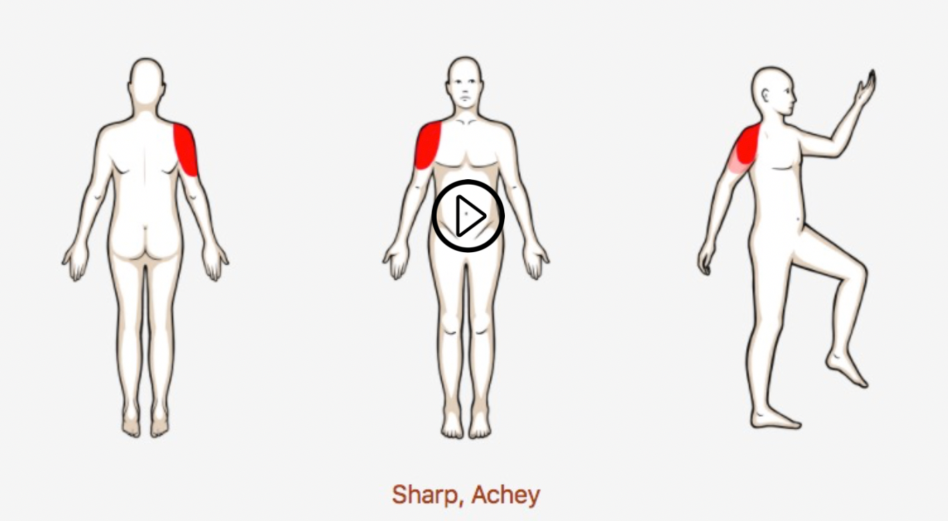 Clinical Pattern Recognition - Shoulder Pain — PhysioU