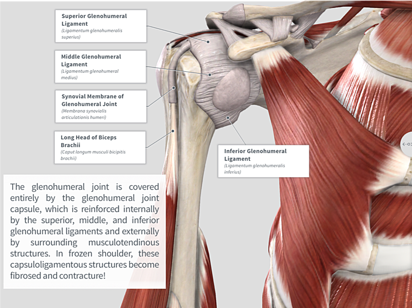 Adhesive Capsulitis (Frozen Shoulder) | Clinical Pattern Recognition