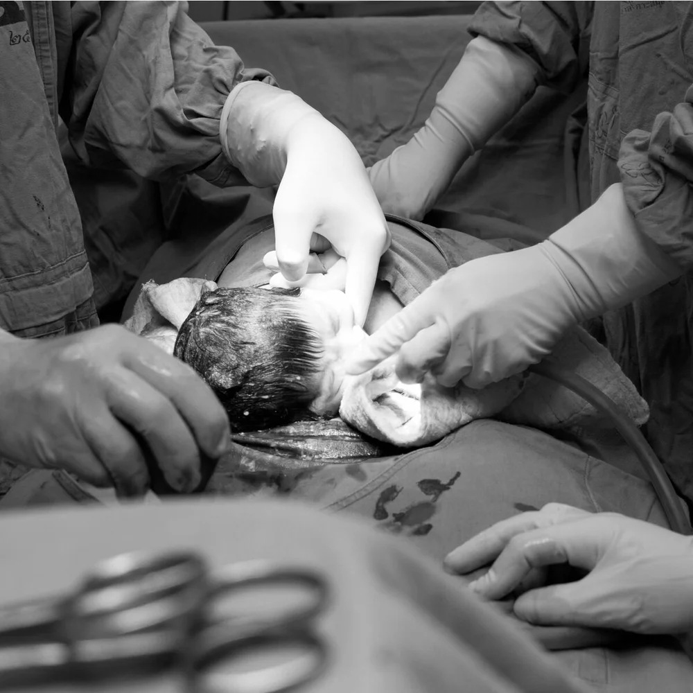 Cesarean Birth: What to Expect — High Country Doulas