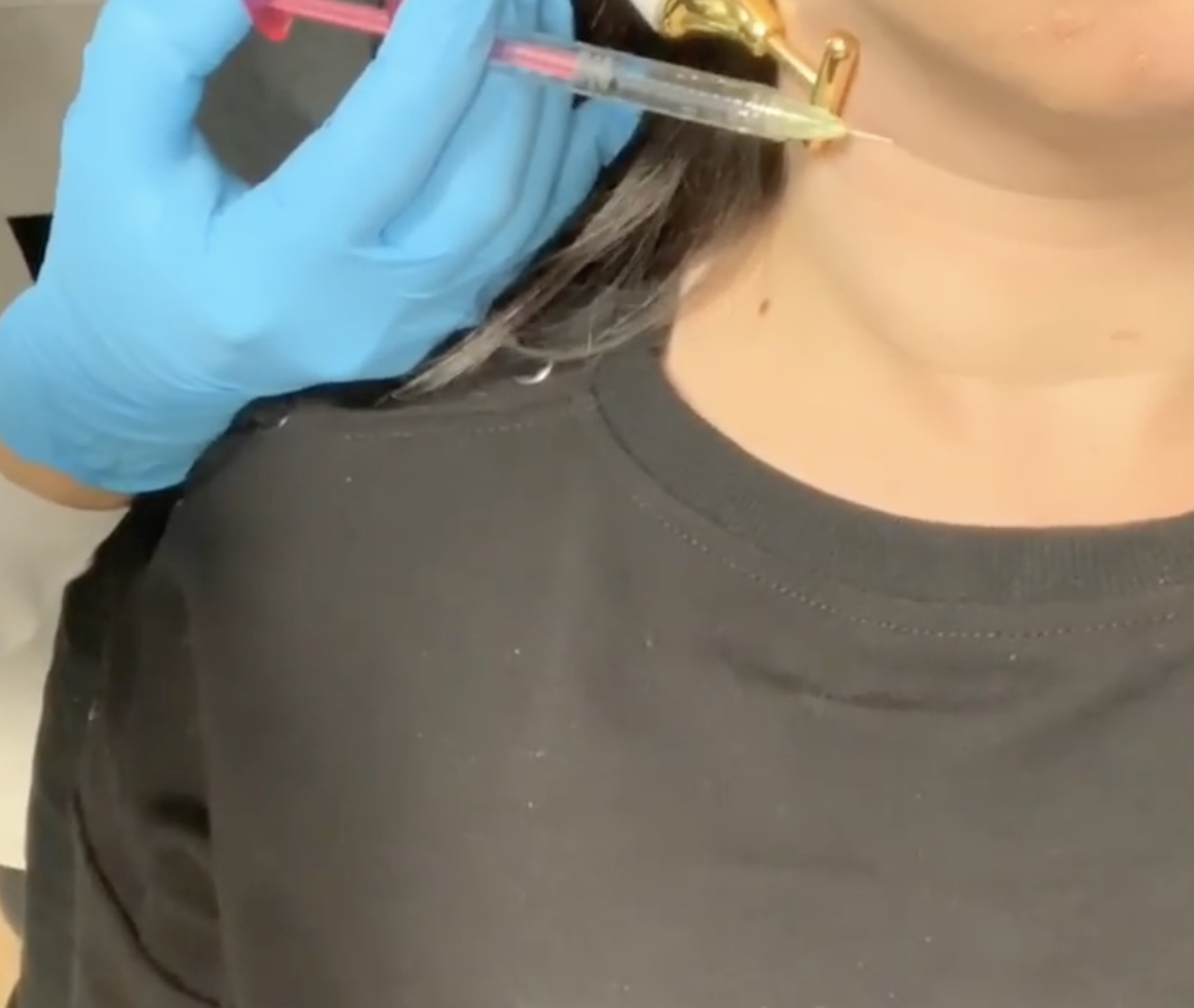 How To Get Rid Of Tech Neck? Micro-Botox is Here to Help! — Urban You ...