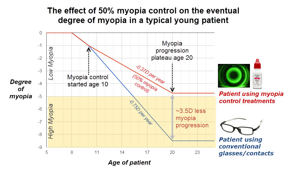 Bay Eye Care — Myopia Control (Slowing Short-sightedness)