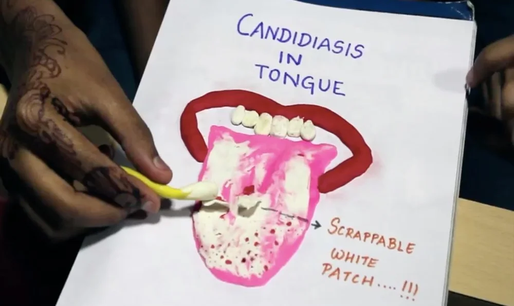 Teaching & Learning — Oral medicine @ Saveetha