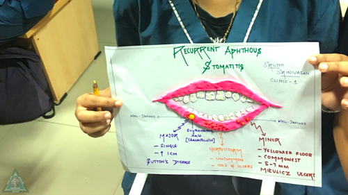 Teaching & Learning — Oral medicine @ Saveetha