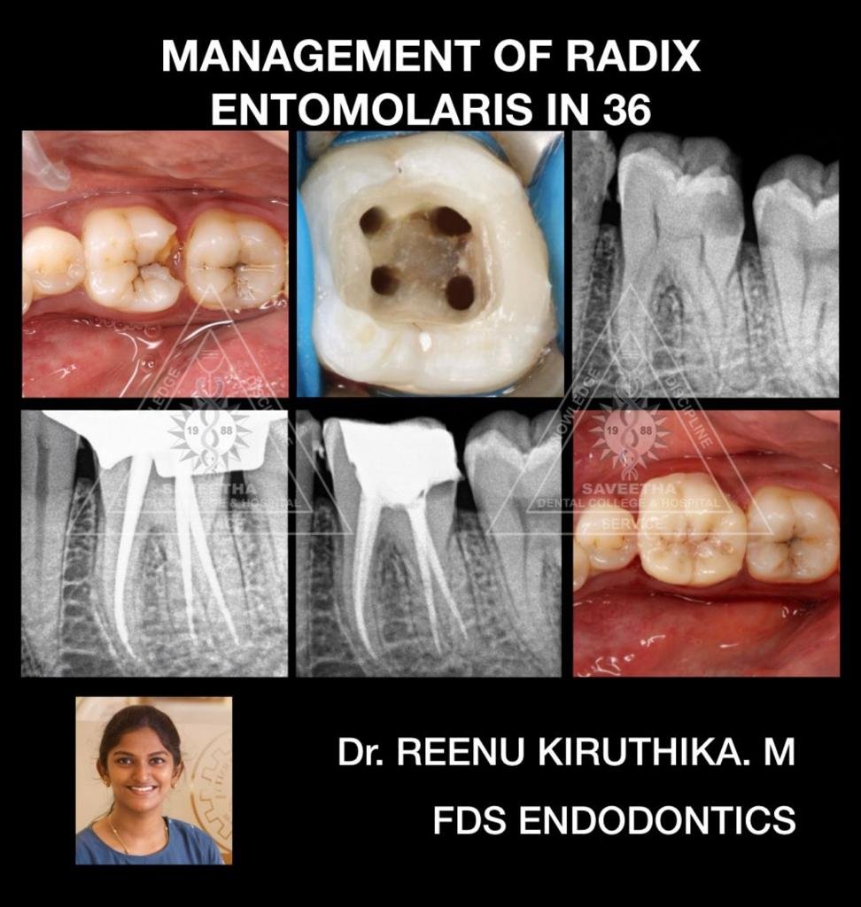 Case of the Week — Cons Endo