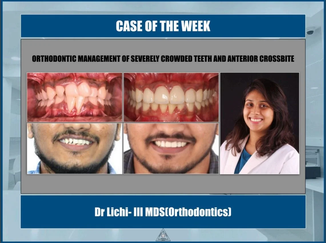 CASE BLOG — orthodontics - SDC