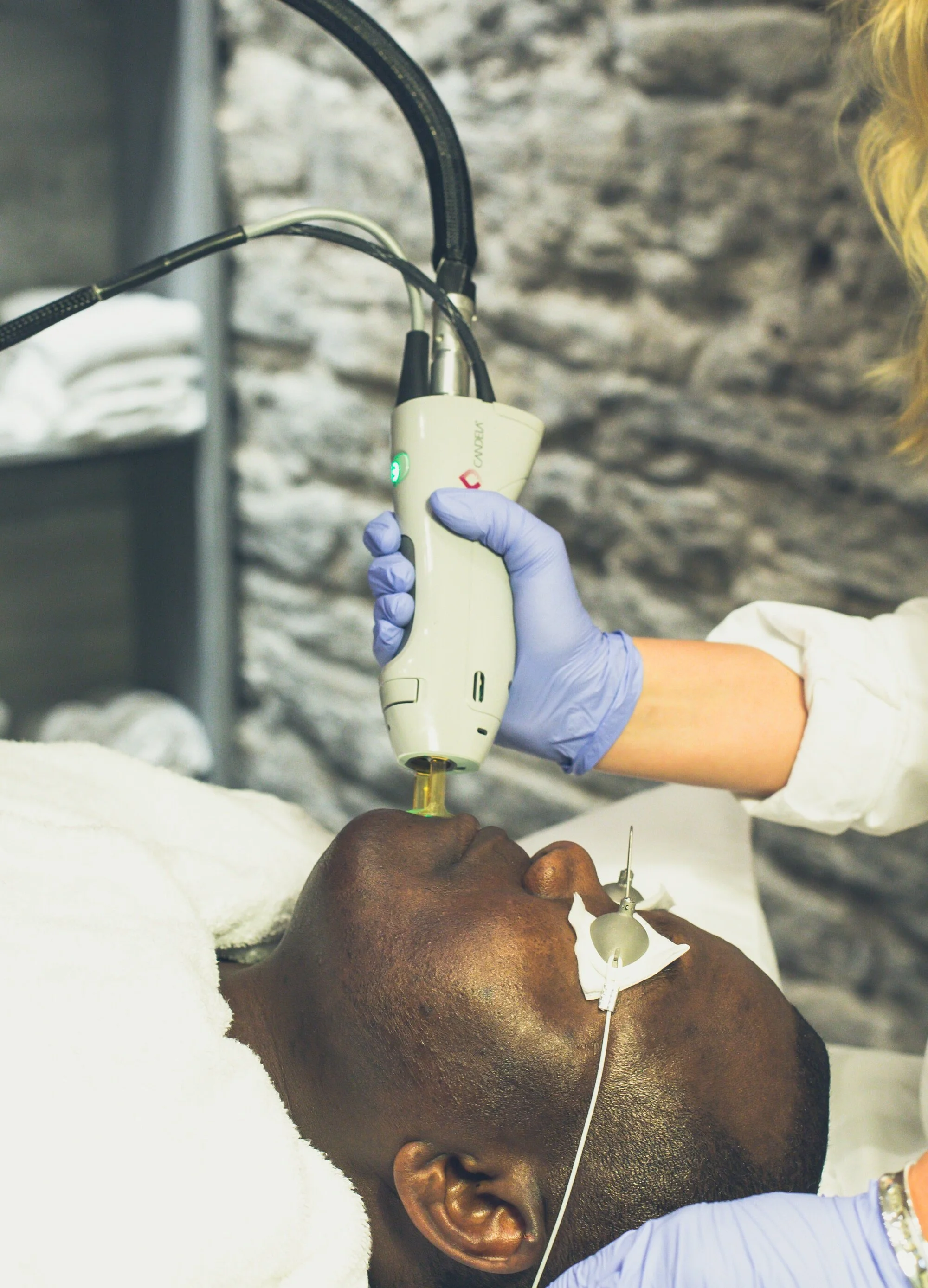 Transgender Laser Hair Removal — Mill City Laser | Minneapolis Laser ...