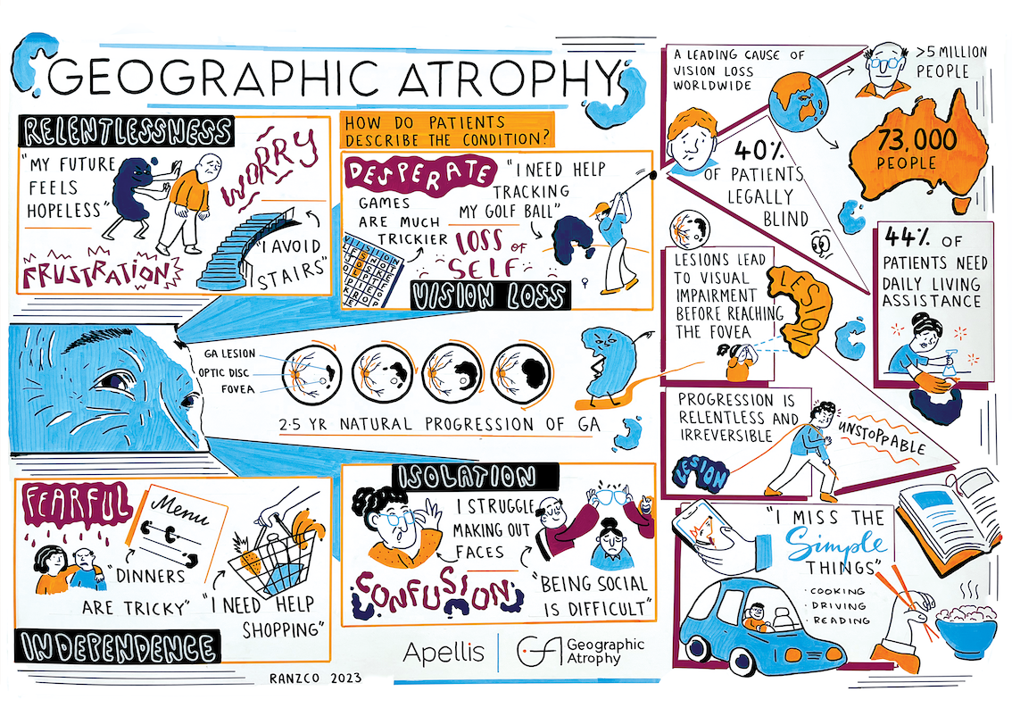 Geographic Atrophy Pop Up Stand — Tuna Blue