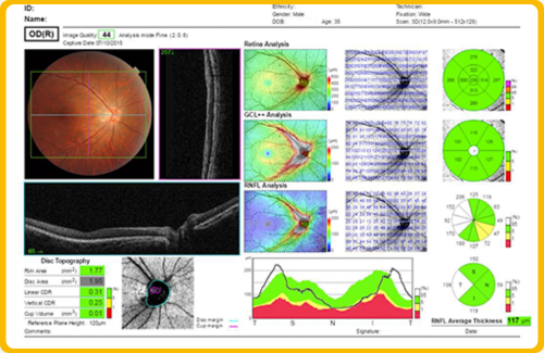 Eye Services | EyeJoy