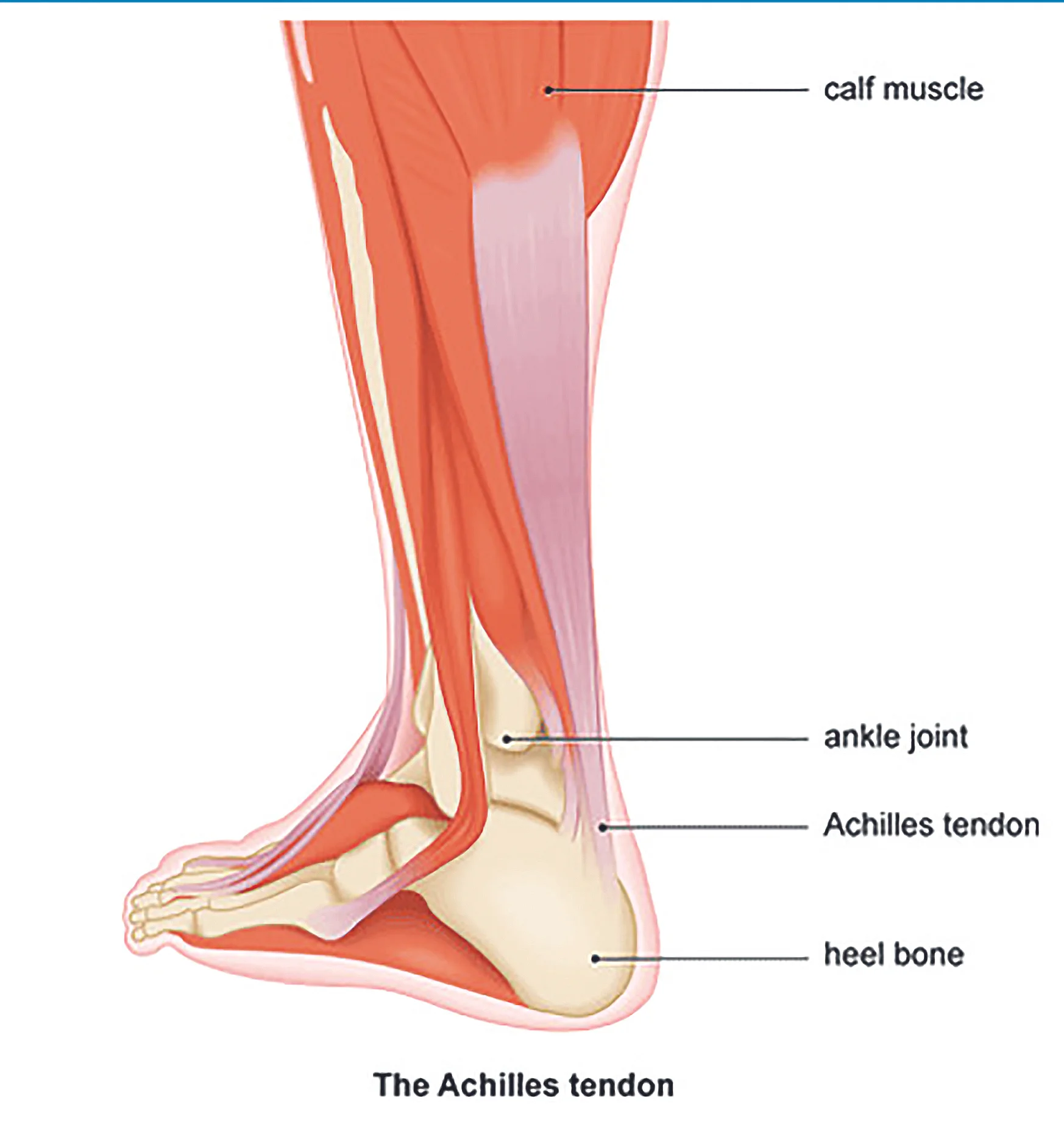 Interesting Case Achilles Tendon Laceration From Broken Saw Blade 