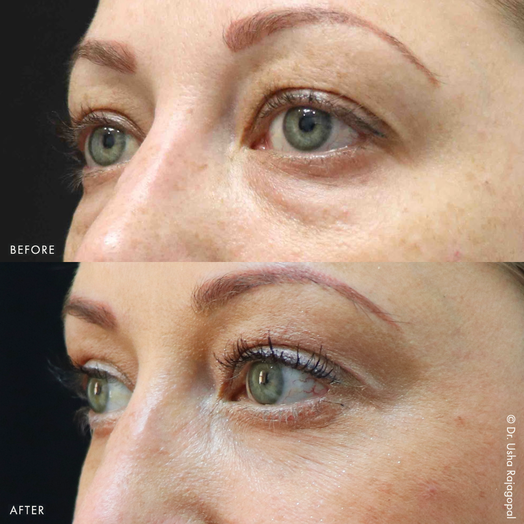 San Francisco Plastic Surgery & Laser Center | Usha Rajagopal, MD