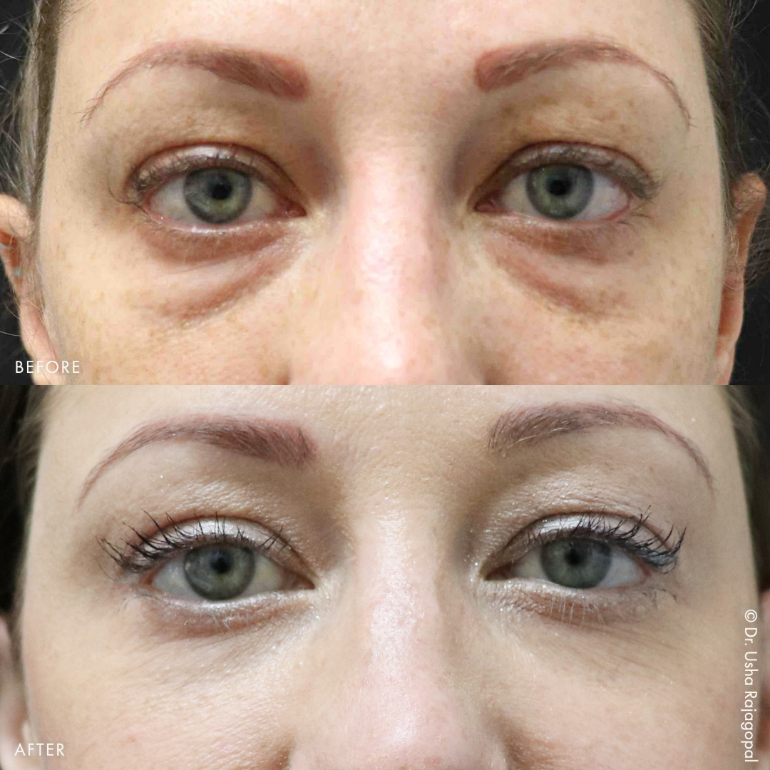 San Francisco Plastic Surgery & Laser Center | Usha Rajagopal, MD